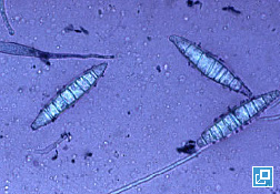 Microsporum Canis Macroconidia