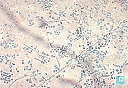 DERMATOPHYTOSIS | Zoetis CA