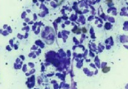 Sebaceous Cyst Dog Cytology