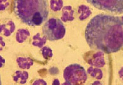 Epidermal Inclusion Cyst Cytology Dog