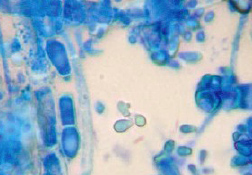 Microsporum Gypseum In Dogs