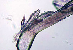 Trichogram | Zoetis CA