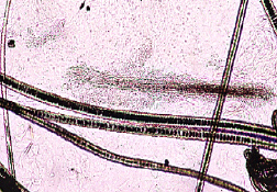 Trichogram | Zoetis CA