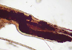 Trichogram | Zoetis CA